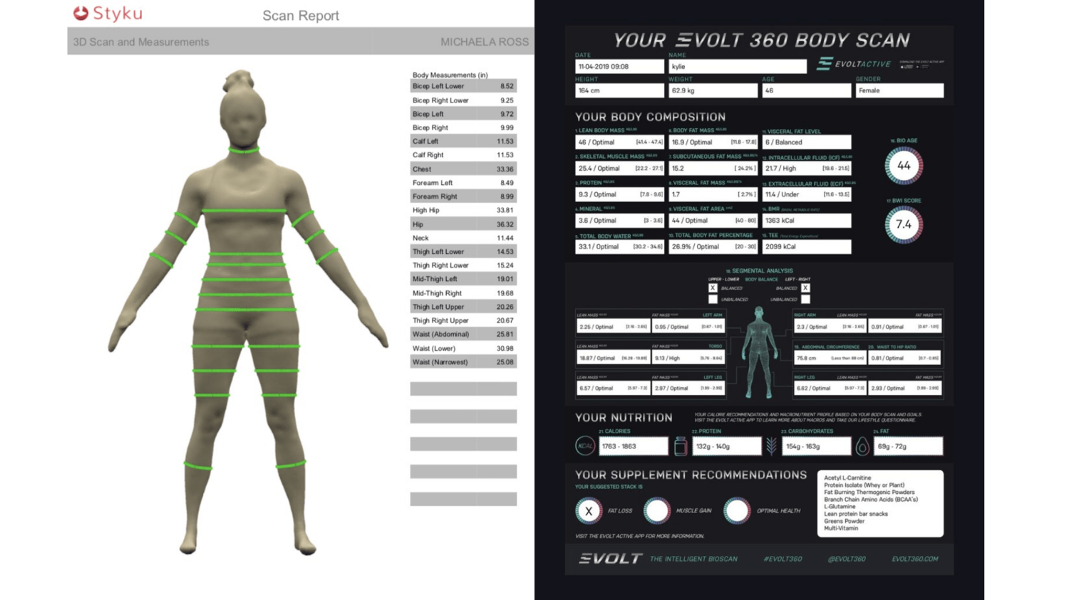 Styku vs. Evolt 360: A 3D Body Scanner Comparison